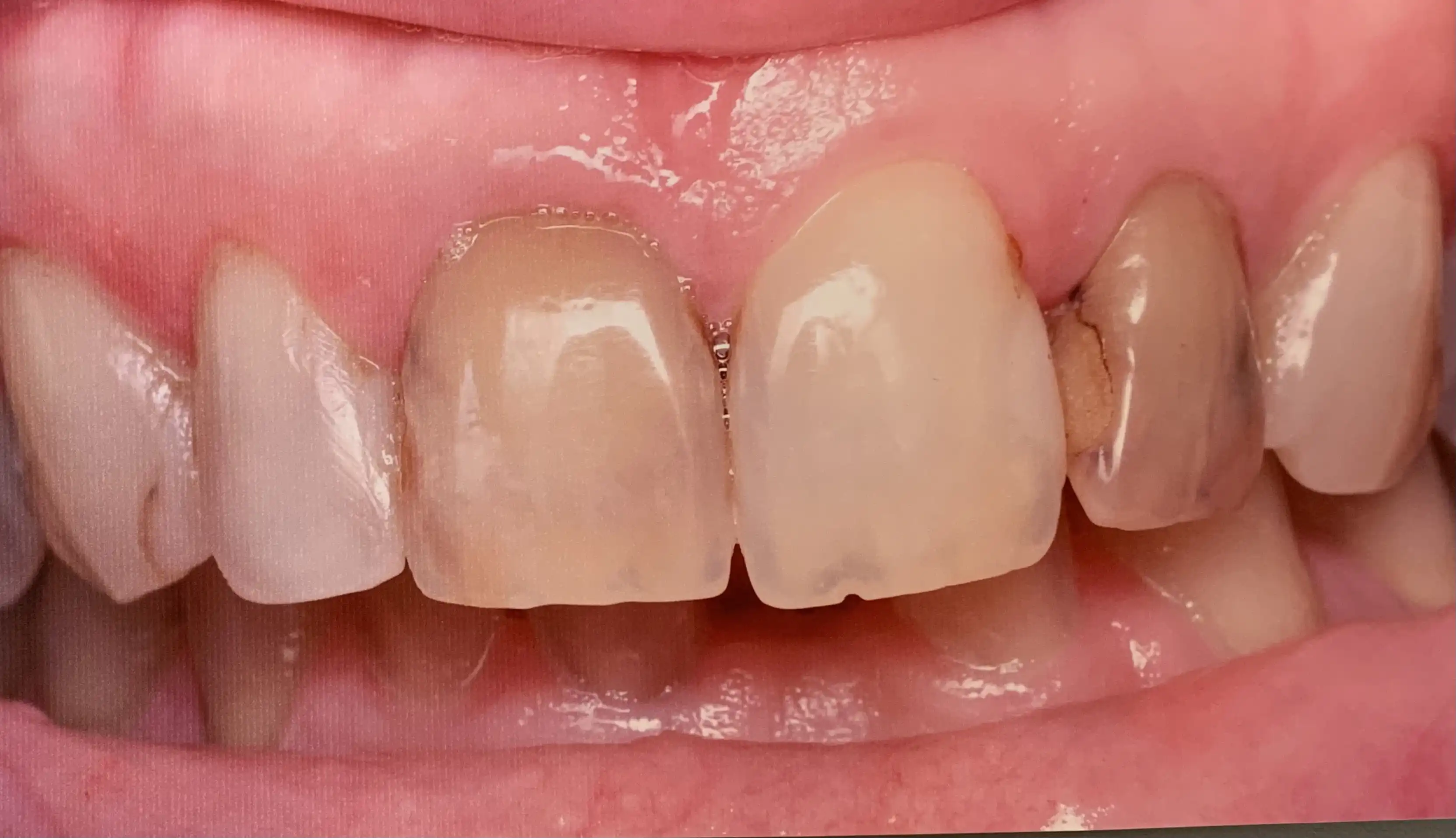 Dentist Massapequa New York | Dental Health, Cosmetic, and Implant ...