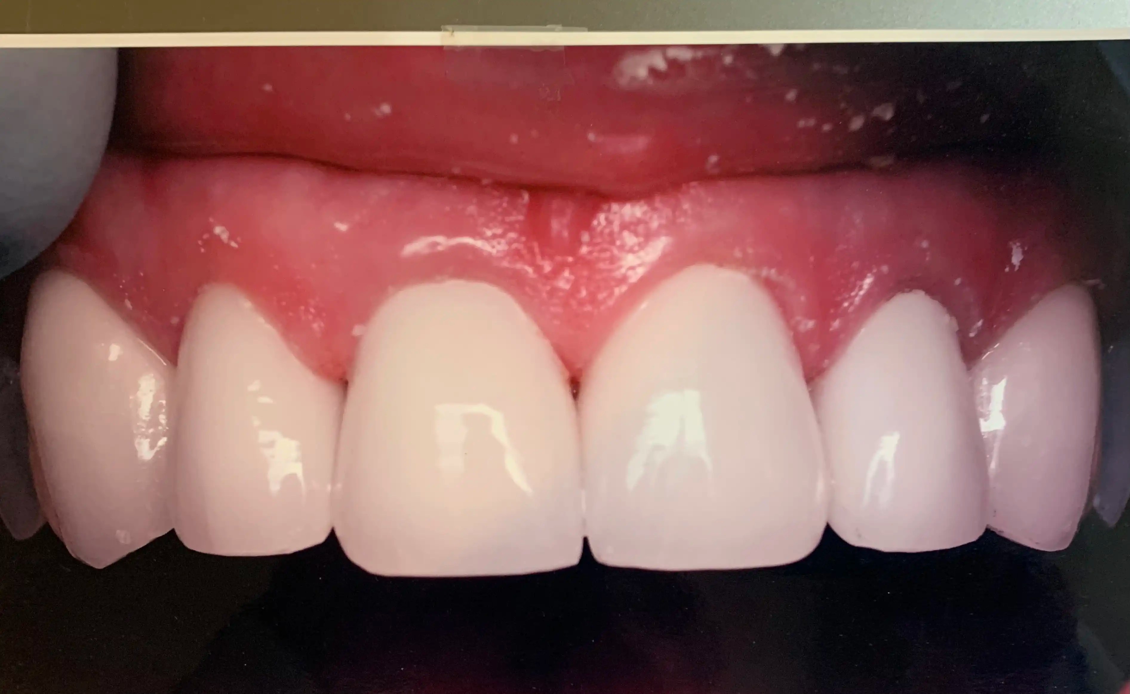 Dentist Massapequa New York | Dental Health, Cosmetic, and Implant ...