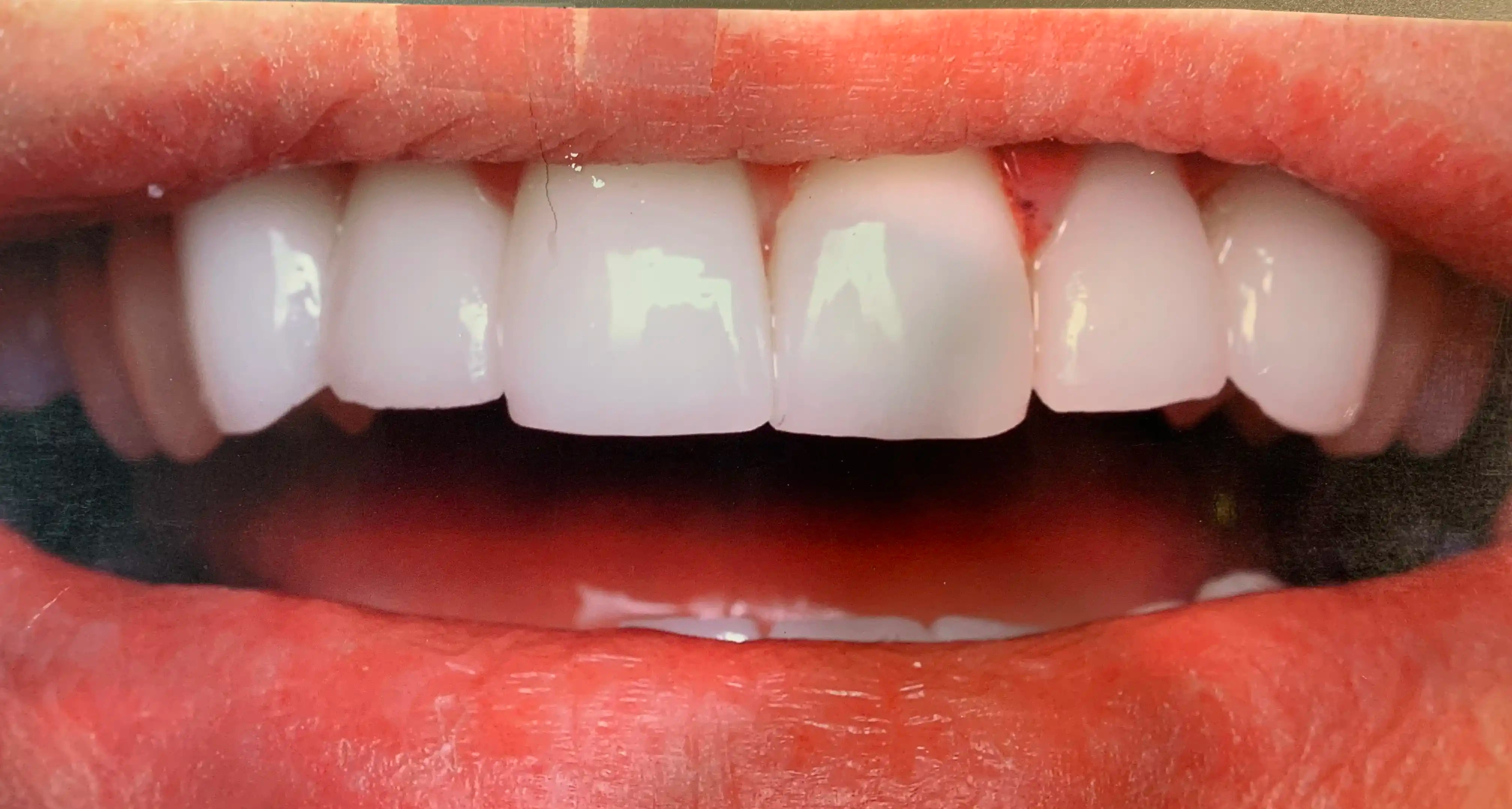 Dentist Massapequa New York | Dental Health, Cosmetic, and Implant ...